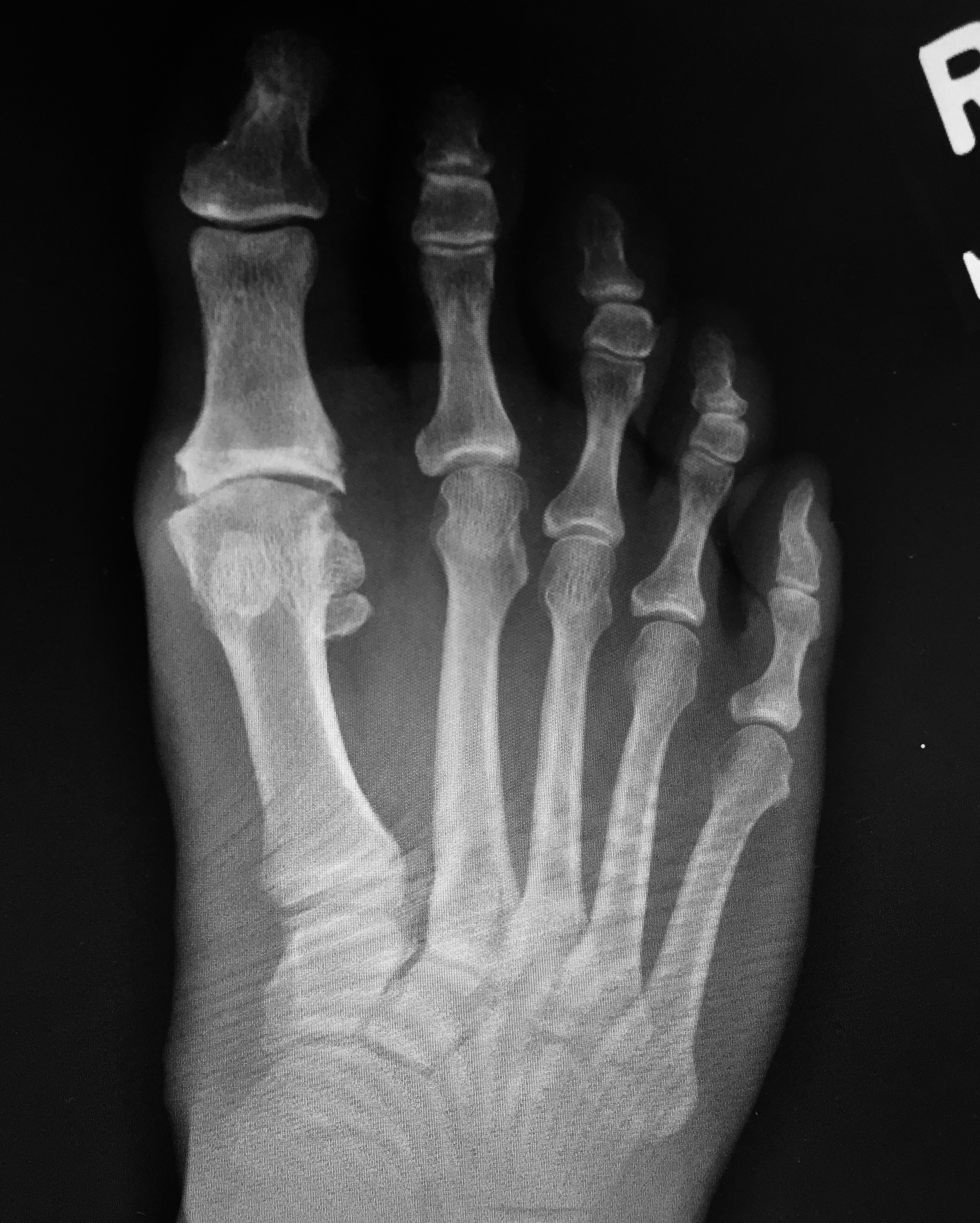Image 1: XRAY – PrePodiatryStudy