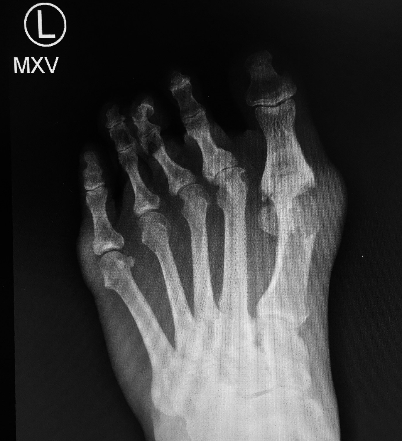 Image 2: XRAY – PrePodiatryStudy