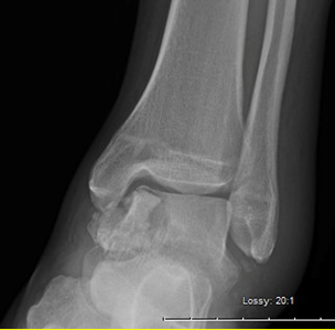 Image 7: XRAY – PrePodiatryStudy